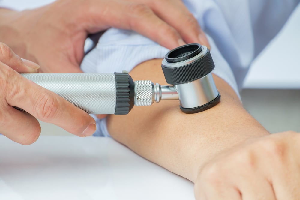 The Importance of Skin Checkups, Dania Dermatology, Dania, FL