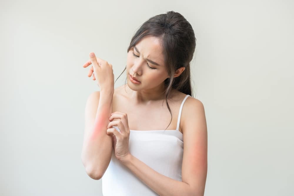 Common Causes of Winter Rashes and How to Combat Them
